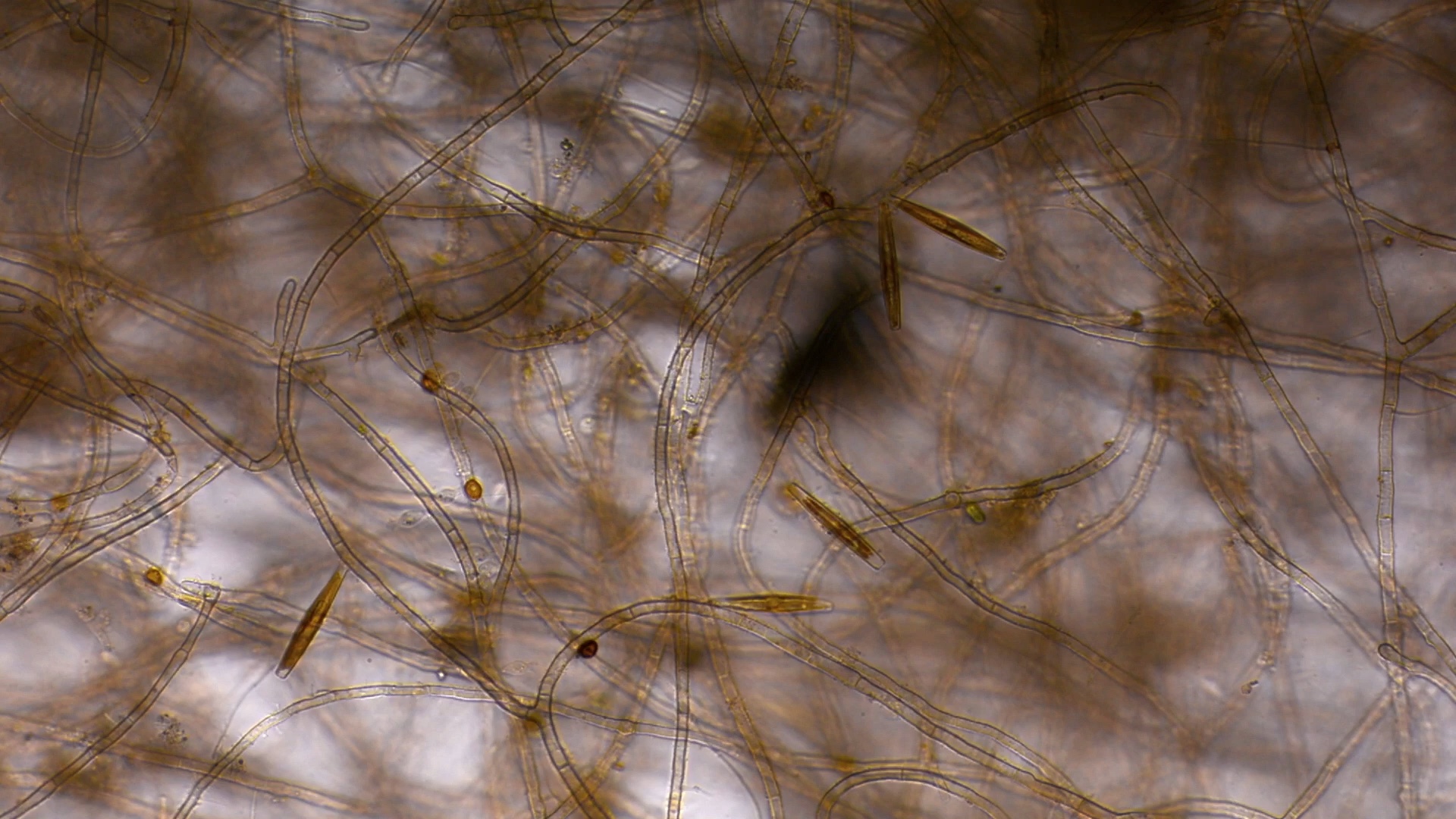 显微镜下鱼缸水体中的微生物系列