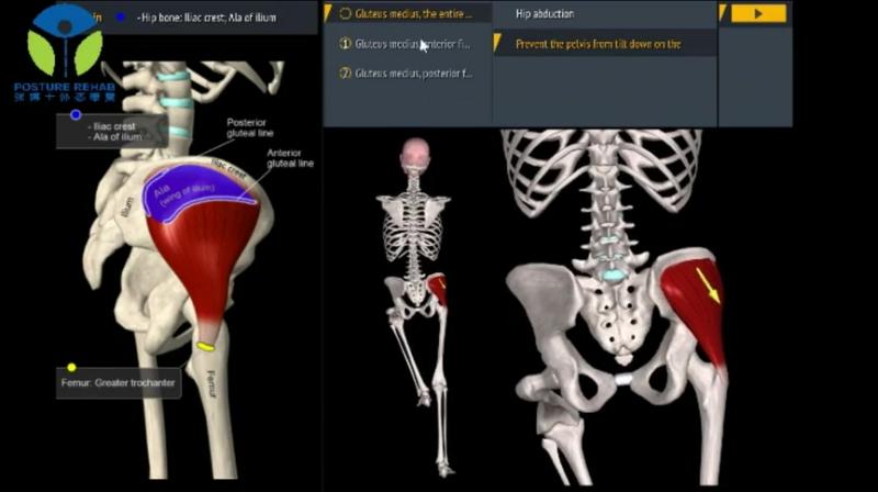 3D动画课堂:走路骨盆左右摆动,可能与臀中肌无力有关