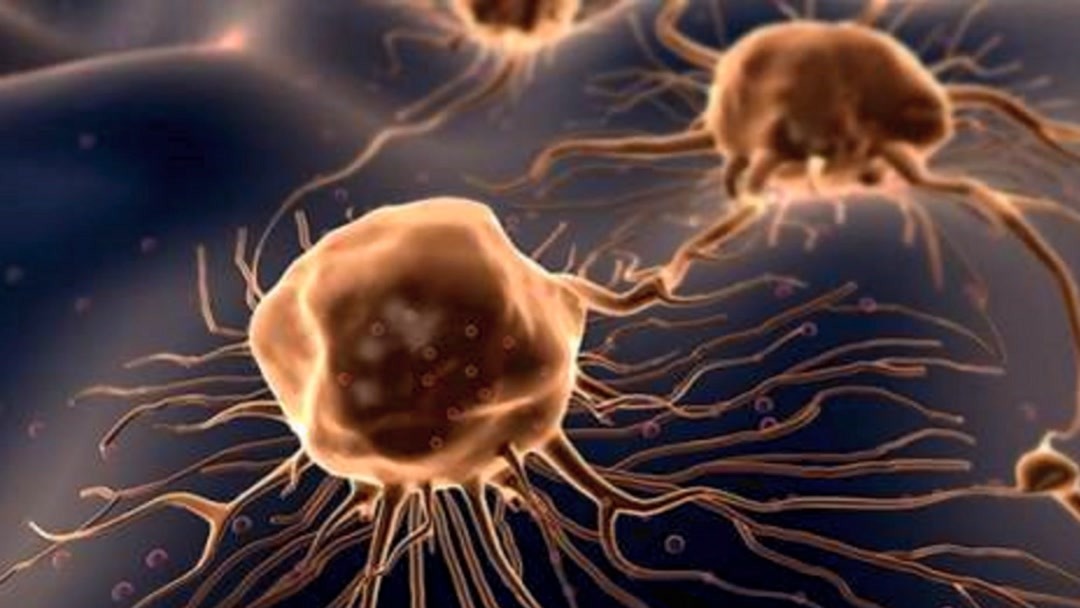 肿瘤早期病人疼痛难忍,专家:口服药物解决3-7天病人疼痛