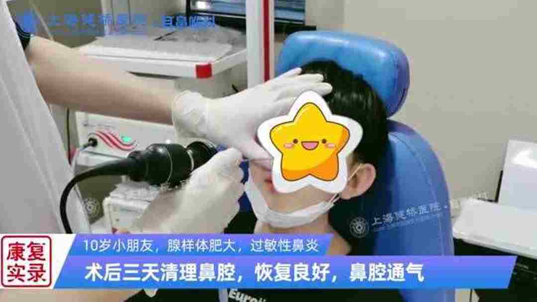 上海健桥医院:腺样体肥大手术治疗过程