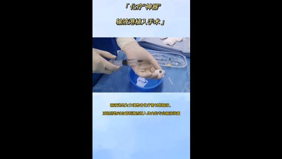 化疗“神器”——输液港植入手术