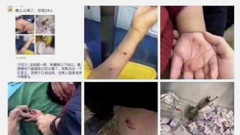 突发!温州流浪狗连续咬伤数十人,最大的伤者高达71岁