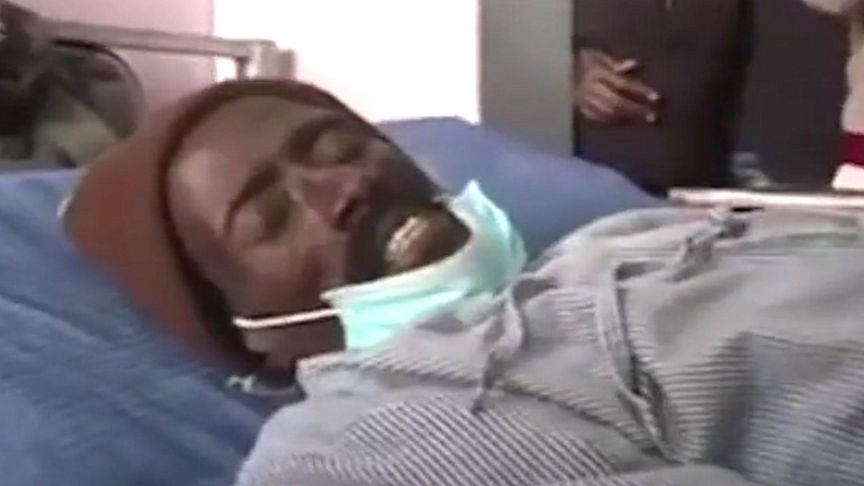 灵异事件?男子被宣告死亡送进停尸房,做防腐处理却被痛“活”了