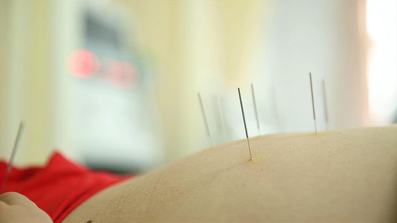 针灸减肥有副作用吗?副作用是什么呢?