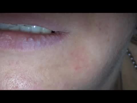 根管治疗下-口腔一点通小程序