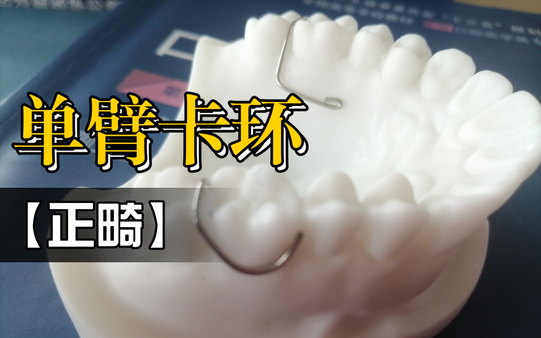【正畸】单壁卡环的弯制