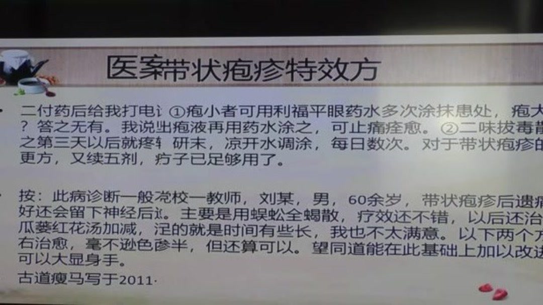 中医治疗带状疱疹的方法