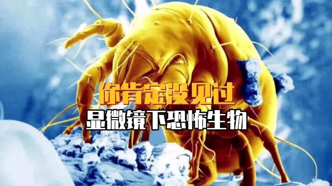 你肯定没见过显微镜下的恐怖生物