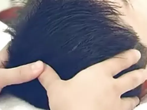 中医自然疗法之刮痧(上集)