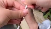 家里小孩难免磕磕碰碰?备上这个碘伏棉棒,小伤口就能轻松处理