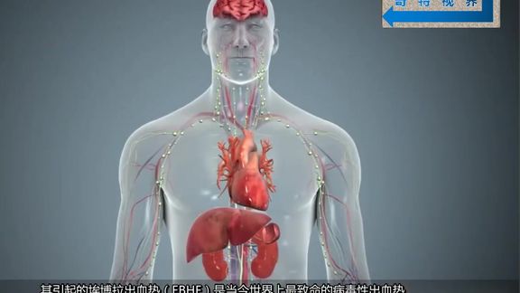 全球最可怕的“病毒”死亡率高达90%!艾滋病在它面前不值一提