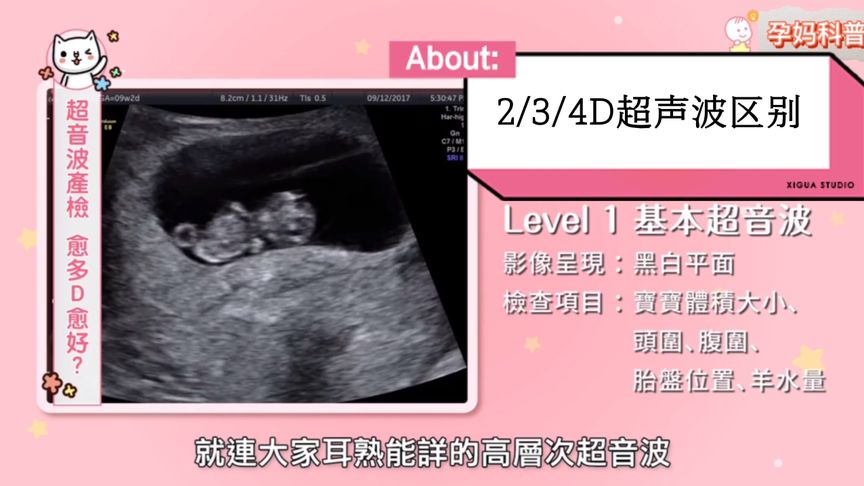 新手宝妈必知,2D超声波3D4D超声波有什么区别?需要做最贵的吗?