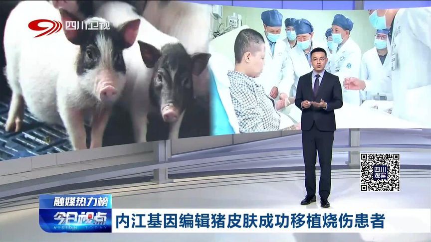 内江基因编辑猪皮肤成功移植烧伤患者