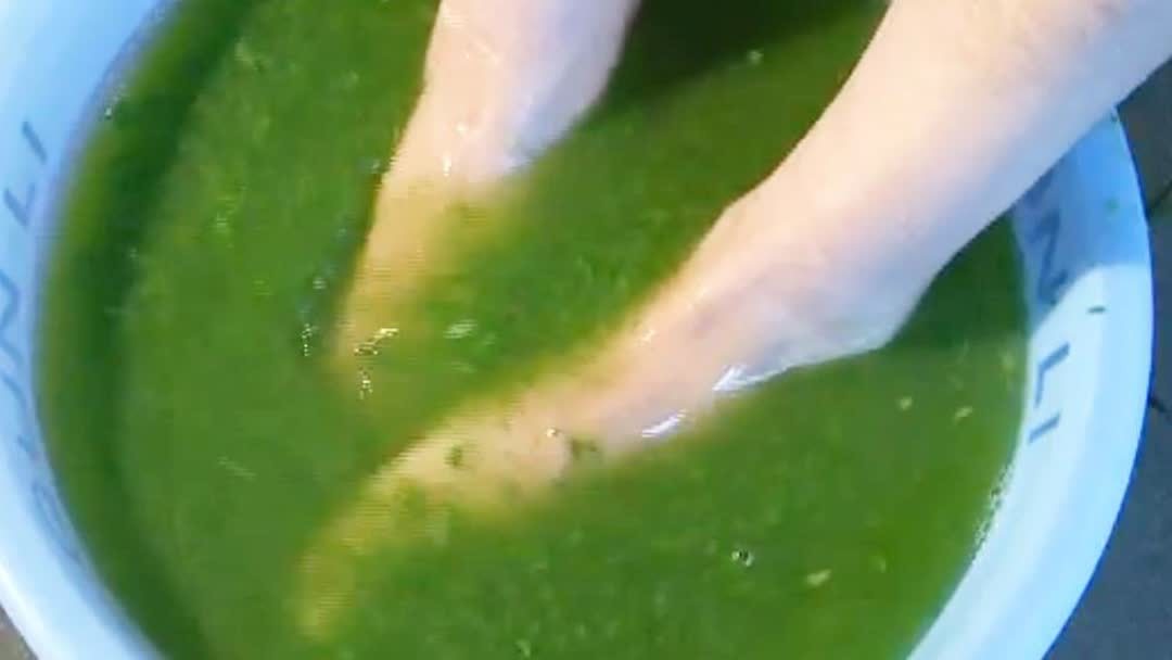 脚气老是治不好怎么办?用这种蔬菜汁泡脚可缓解症状