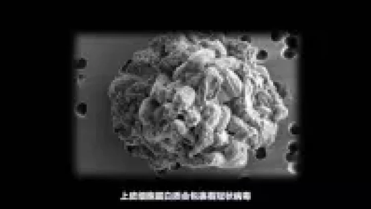 回形针新型冠状病毒肺炎的详细介绍!