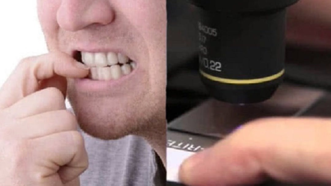 显微镜下的手指甲长啥样?放大观察,你还敢乱啃吗?