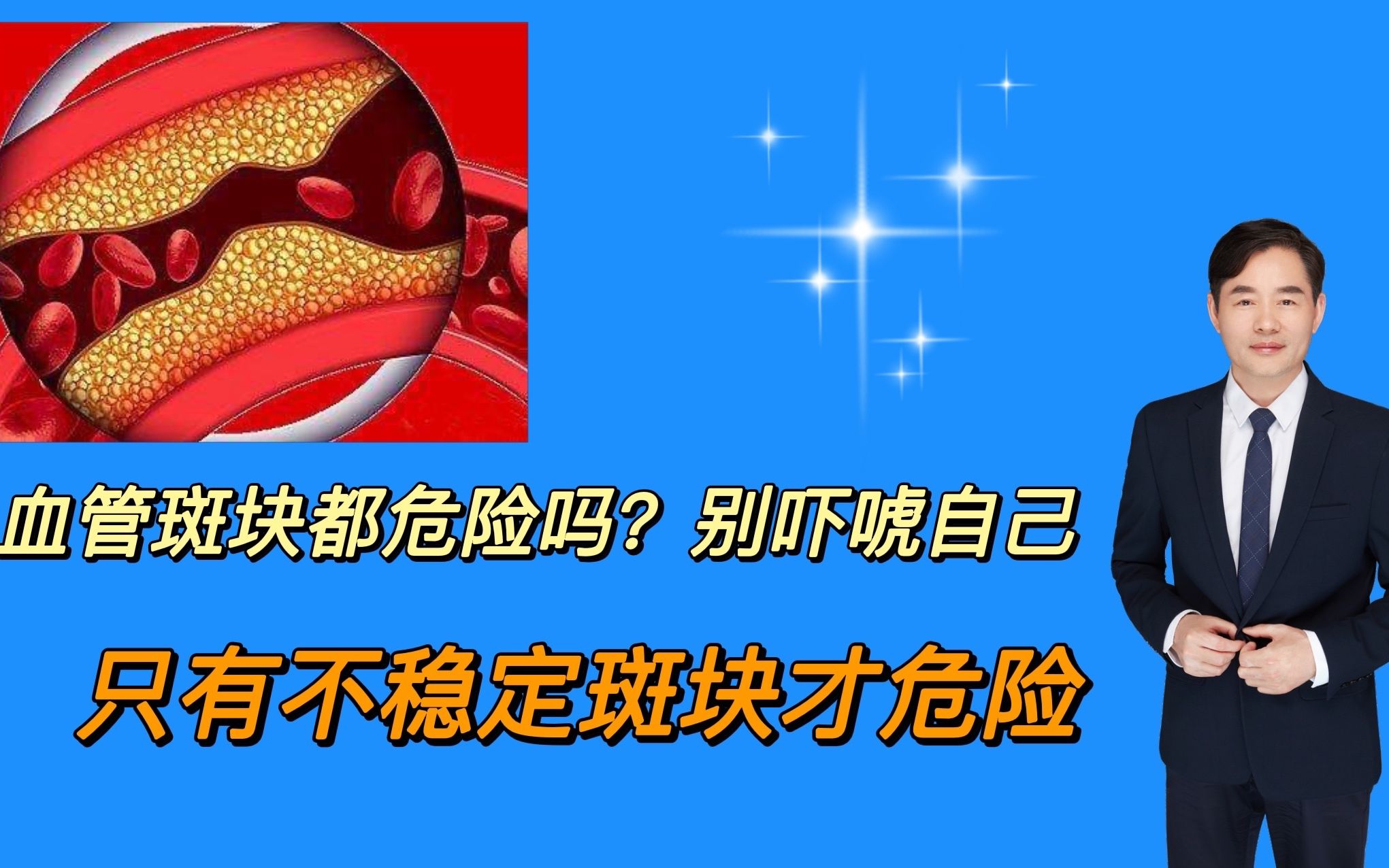 血管斑块都危险吗?错!只有不稳定的斑块才危险!教你如何识别