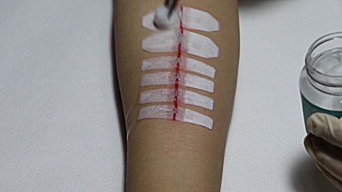 北京阳光宜康缝合器、无创缝合器抗张性与粘性试验