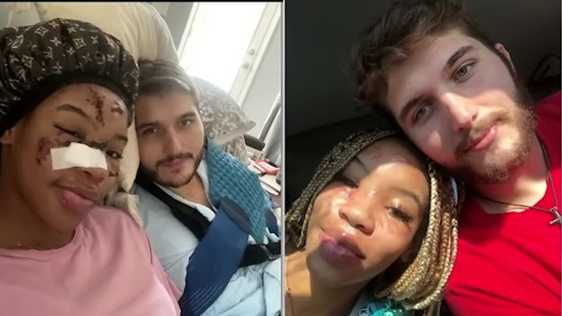 情侣从40米高瀑布摔下重伤就医,意外查出癌症,及时治疗保命