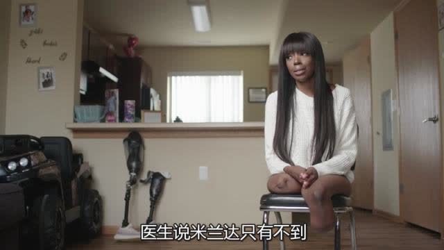外国女人双腿截肢没有手指,却能成为残疾模特,鼓励粉丝热爱生活