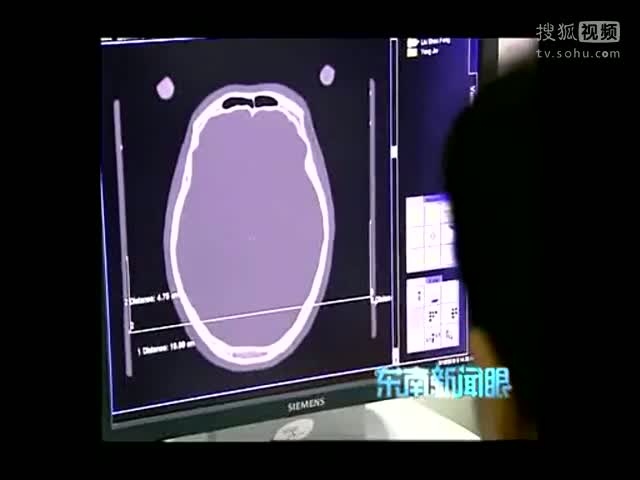 精神分裂治疗方法_偏执型精神病的早期症状