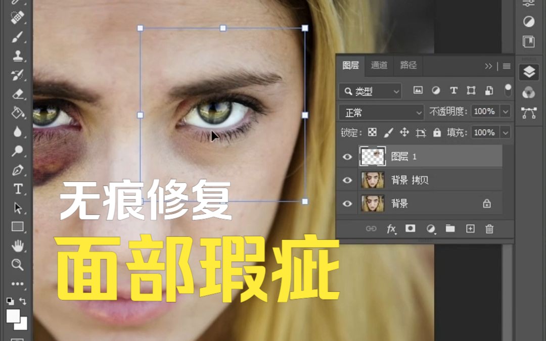 PS小课堂 | 简单几步完美修复面部瑕疵