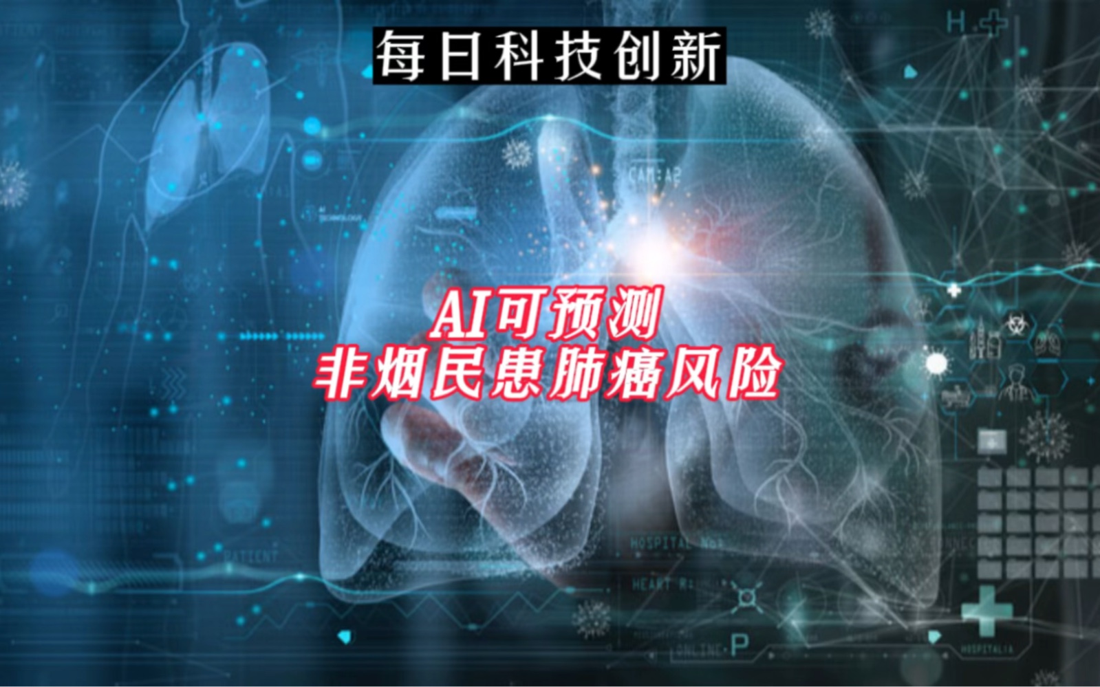 【每日科技创新】AI可预测非烟民患肺癌风险,准确度远超目前方法