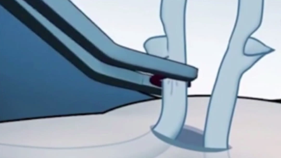 原来男性结扎手术是这原理,牛人3D动画模拟手术全过程!长知识了