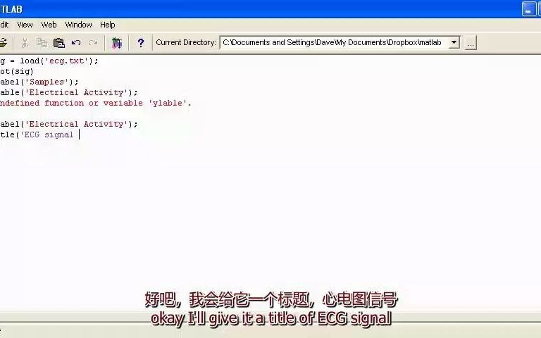 使用 Matlab 进行信号分析 - 心率示例