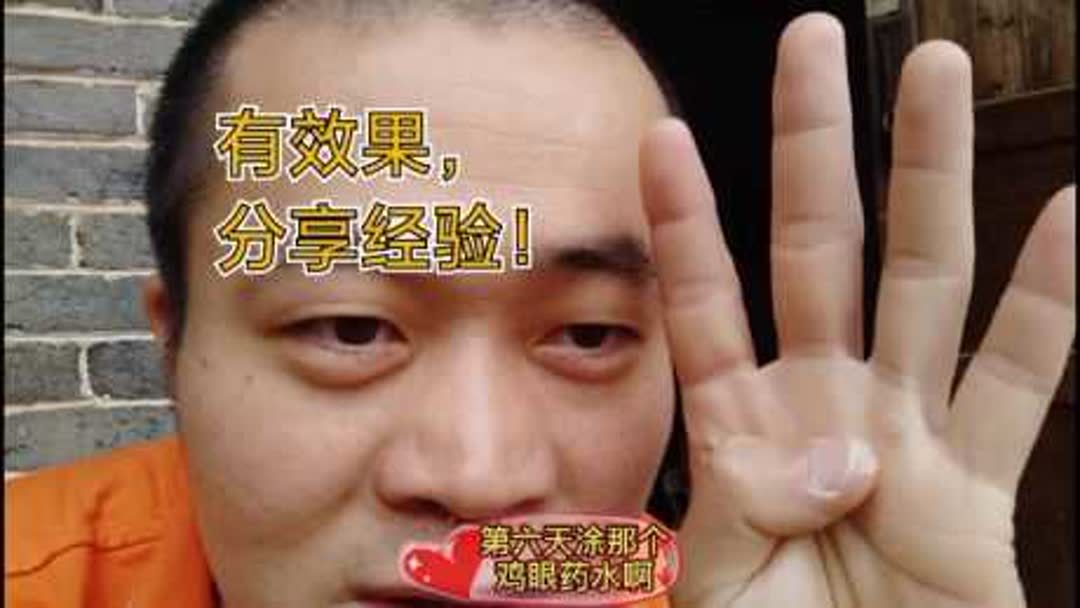 第六天涂鸡眼药水了啊!谈下感受。