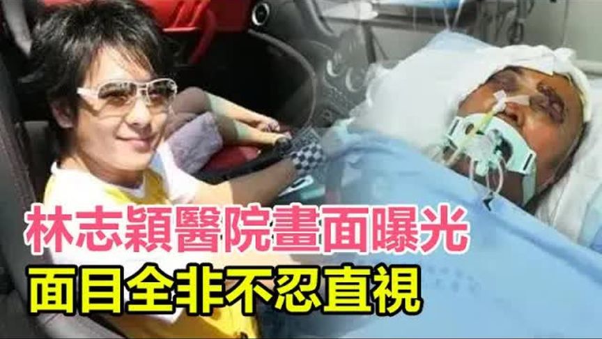 林志颖医院画面曝光:脸部受伤严重!面部重建至少一年!