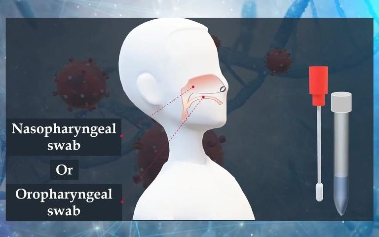 冠状病毒测试:RT-PCR-动画视频
