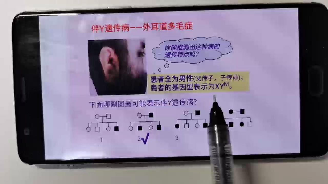 高中生物一轮复习必修一 1.49伴性遗传第二节