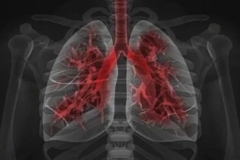 关于新型冠状病毒肺炎,你关心的都在这里