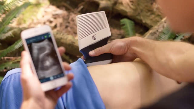 单手握持的超声波仪器,连接手机就能检查身体,看完长见识了