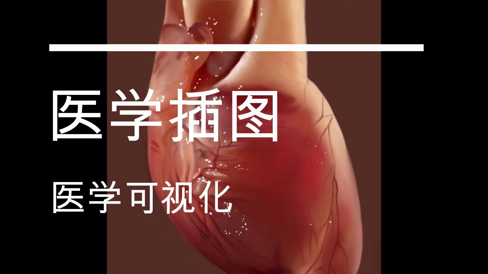 医学插图医学插画医学手绘医学可视化手术示意图矢量图解剖科普