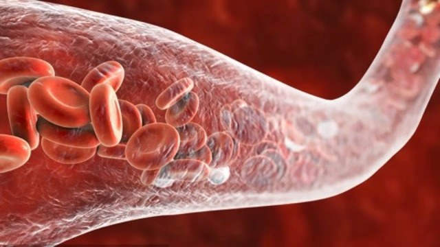 血管堵塞诱发血栓,5"高"食物要少吃,血液全身流通,不怕堵!