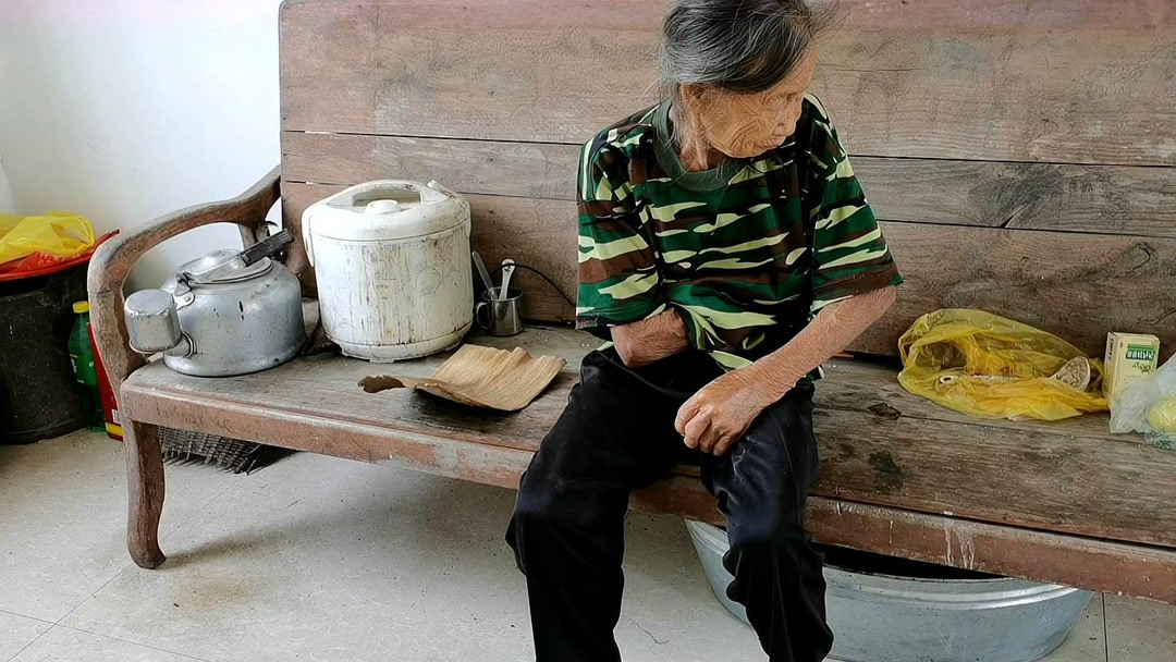 壮家奶奶得一种皮肤病,一直要挠痒痒,赤脚医生收费35元贵吗