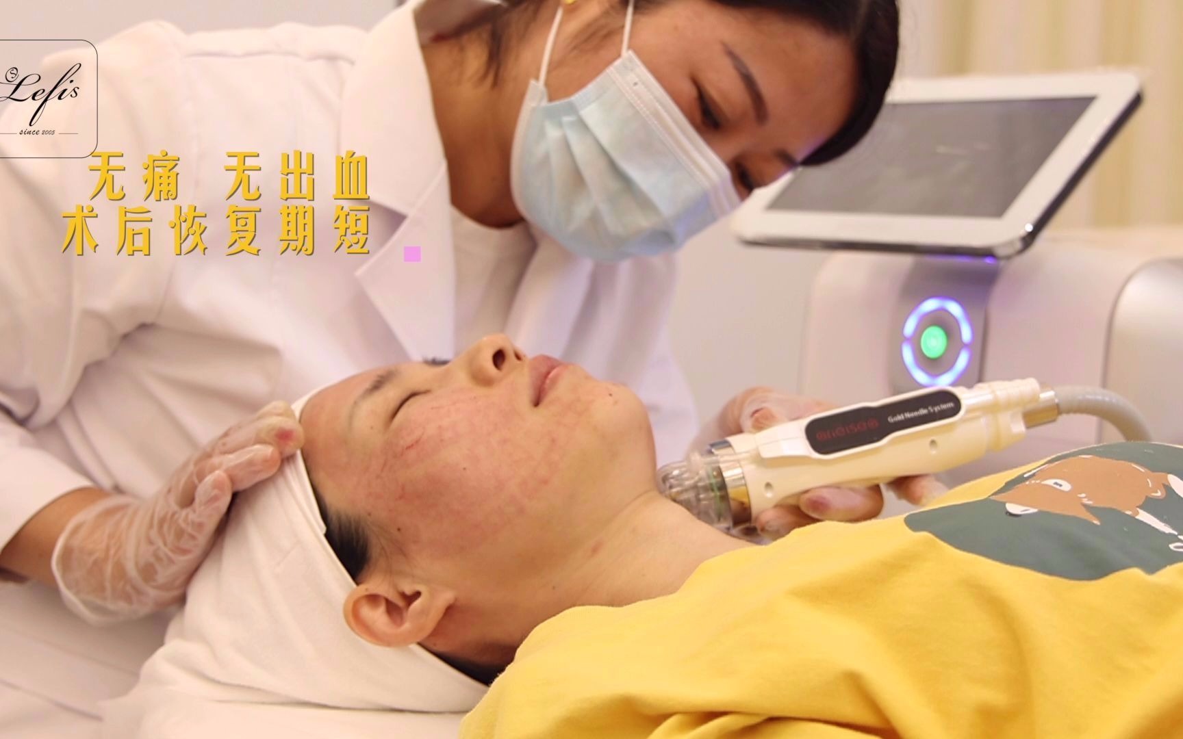 毛孔粗大的“救星”——黄金微针美容仪器的正确操作步骤(雷翡士)