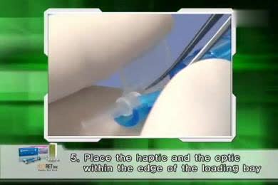 人工晶体推注器COMPORT型号使用说明