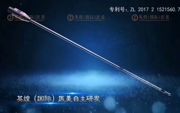 我们的取脂针不一样.所以恢复的快 成活的好