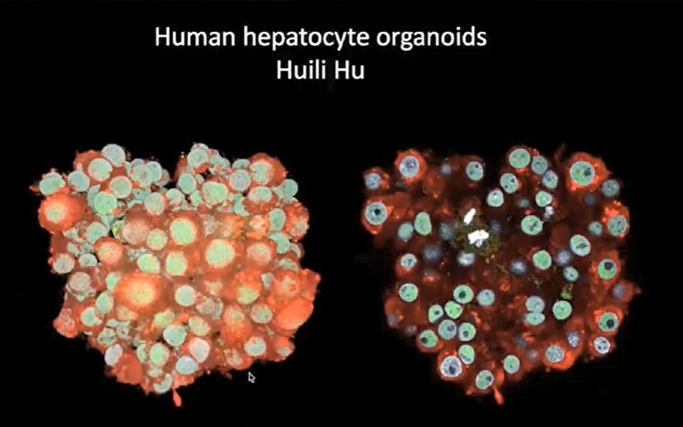 类器官与人类疾病模型-Hans Clevers
