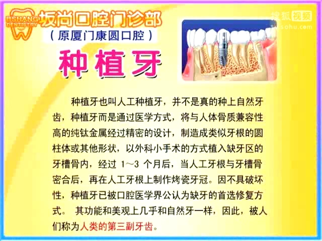 厦门种植牙一般多少钱7000