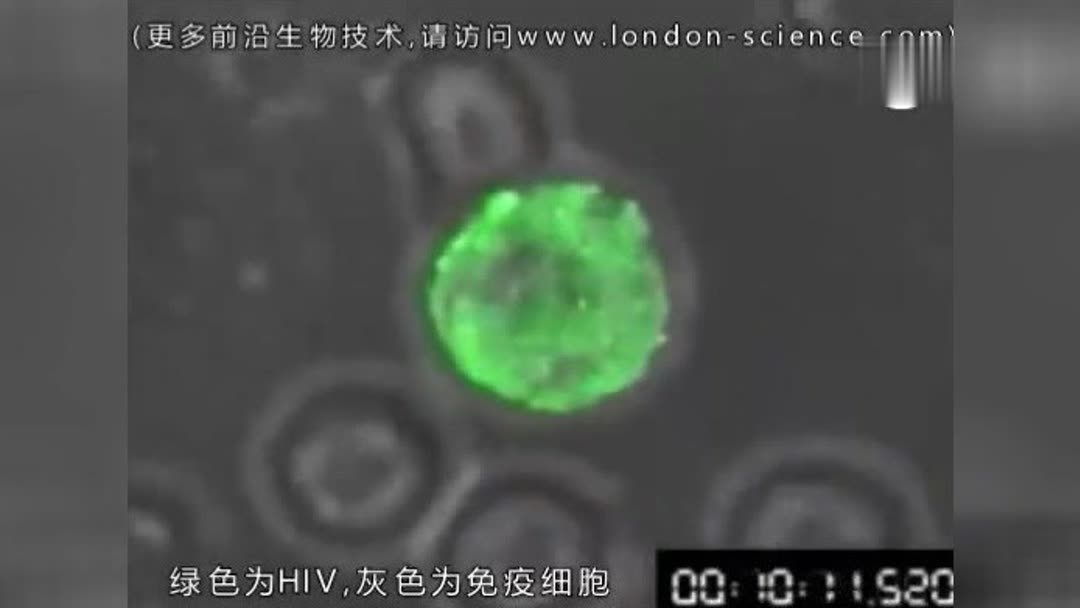 #艾滋病毒科普# 人类免疫缺陷病毒(Human Immunodeficiency
