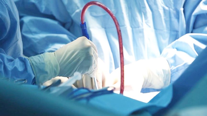 经常头晕,冠心病引起心脑血管狭窄该怎么办?一次给您说明白了