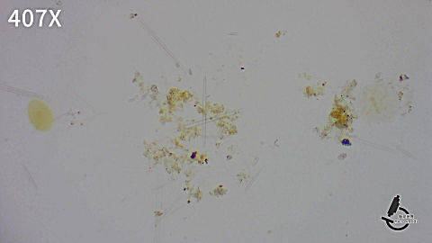 【硅藻装片】光学显微镜放大160/400/1600倍后是什么样子?