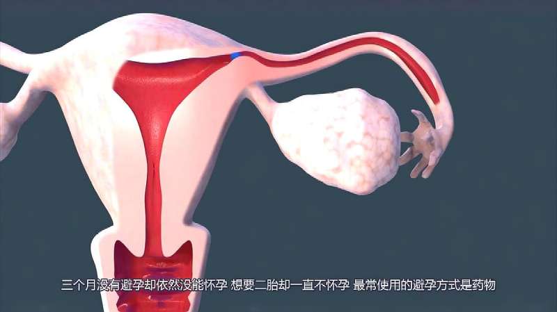 输卵管堵塞早期出现的症状是这些,孕妈们要重视,不然会后悔