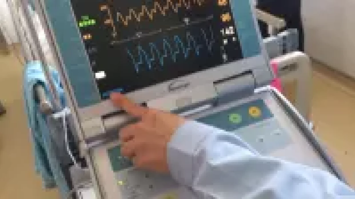 主动脉内球囊反搏(IABP)