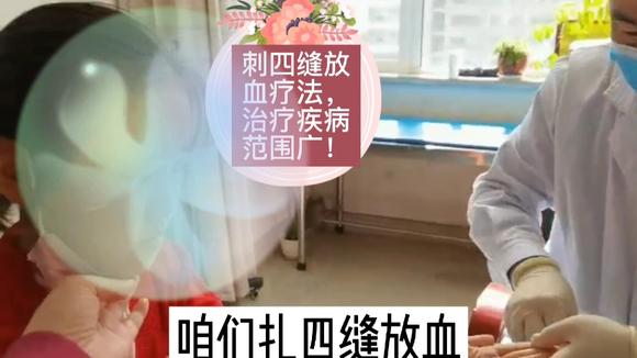 刺四缝放血,不但能治疗小儿疳积,厌食偏食挑食,还能治成人厌食