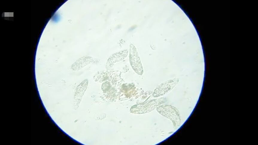 病从口入,微生物的世界